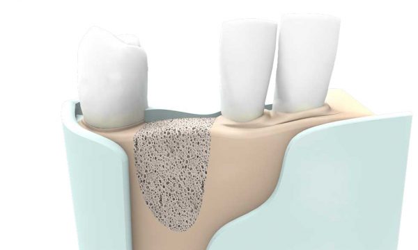 Clínica Dental Dr. Bonastre | Odontología Avanzada en Ontinyent